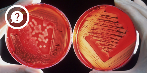 Listeriose - DocCheck Flexikon