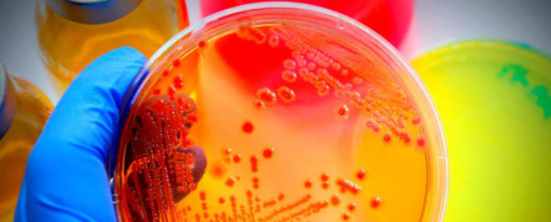 Neues Antibiotikum entdeckt - DocCheck