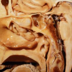 Nasenmuschel - DocCheck Flexikon