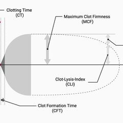 Thrombelastometrie - DocCheck Flexikon