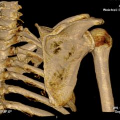 Metaphyse - DocCheck Flexikon