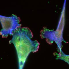 Fibronektin - DocCheck Flexikon