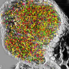 Paracortex - DocCheck Flexikon