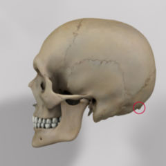 Inion - DocCheck Flexikon