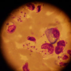 Leishmaniose - DocCheck Flexikon