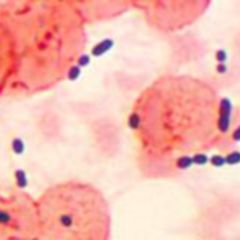 Vancomycin-resistente Enterokokken - DocCheck Flexikon