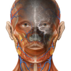Angiogramm - DocCheck Flexikon