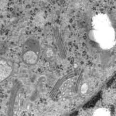 Cisterna basalis - DocCheck Flexikon