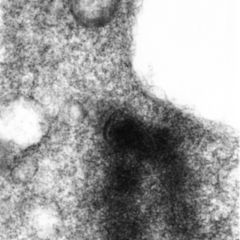 Kinetochor - DocCheck Flexikon