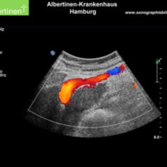 Leberpforte - DocCheck Flexikon