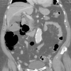 Iatrogen - DocCheck Flexikon