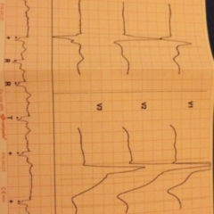 EK - DocCheck Flexikon