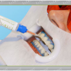 Trisomie 22 - DocCheck Flexikon
