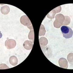 Normoblast - DocCheck Flexikon