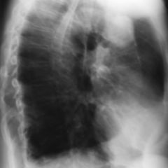 Colon descendens - DocCheck Flexikon