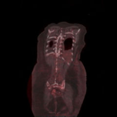 FDG-PET - DocCheck Flexikon