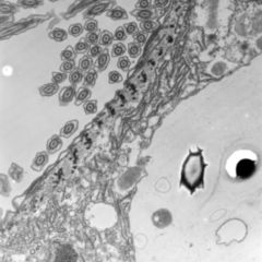 Endosom - DocCheck Flexikon
