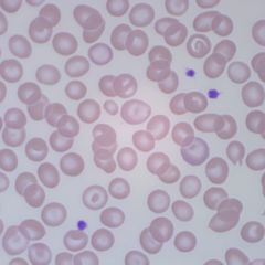 Targetzelle - DocCheck Flexikon