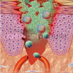 Wundheilung - DocCheck Flexikon