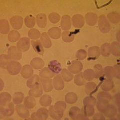 Merozoit - DocCheck Flexikon