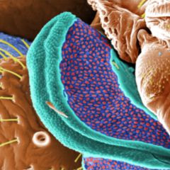 Bettwanze - DocCheck Flexikon
