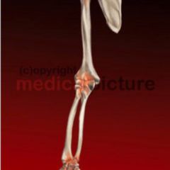 Arthralgie - DocCheck Flexikon