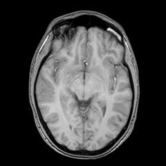 Transversalebene - DocCheck Flexikon