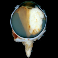 Auge - DocCheck Flexikon