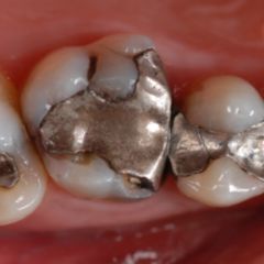 Seitenzahn - DocCheck Flexikon