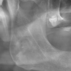 Orthopantomogramm - DocCheck Flexikon