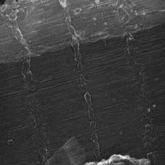 Myofibrille - DocCheck Flexikon