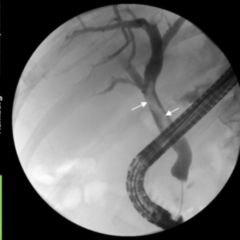 Cholangiographie - DocCheck Flexikon