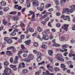 Michaelis-Raute - DocCheck Flexikon