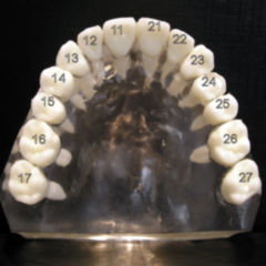 Zahnschema - DocCheck Flexikon