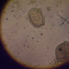 Spulwurm - DocCheck Flexikon