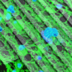 Forel-Feld - DocCheck Flexikon