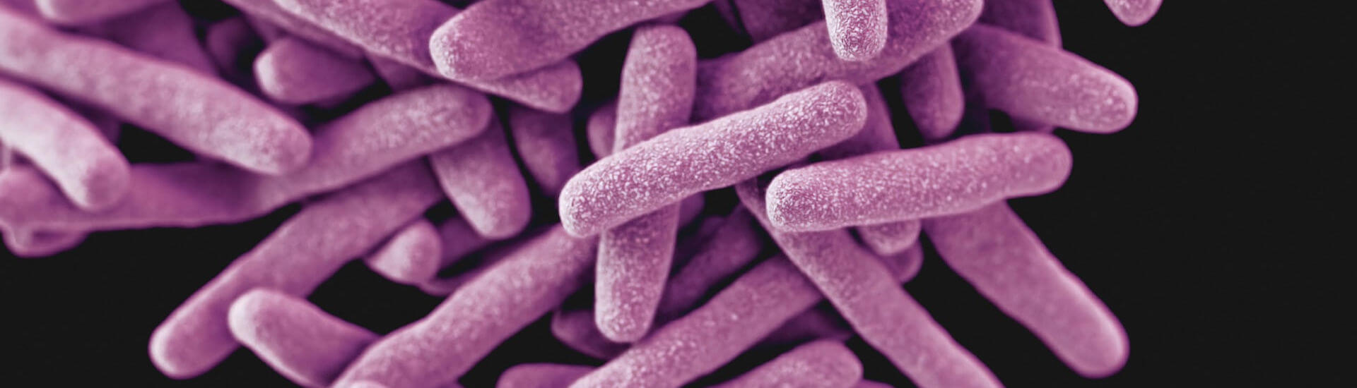 Superbugs und ihre Tricks - DocCheck