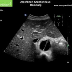 Reissner-Membran - DocCheck Flexikon