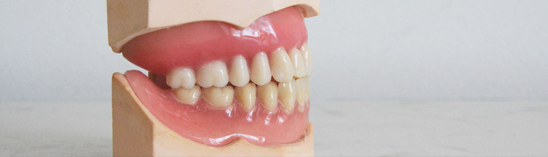 Die neue Parodontitis-Richtlinie - DocCheck