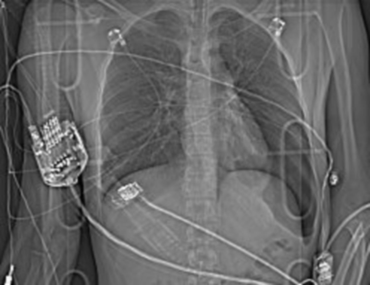 Topogramm der Thorax-CT - DocCheck