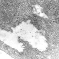 Phagolysosom - DocCheck Flexikon