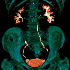 Urographie - DocCheck Flexikon