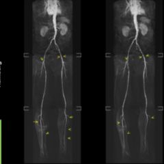 Beinarterie - DocCheck Flexikon