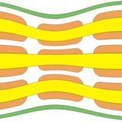 Nervenläsion - DocCheck Flexikon