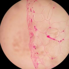 Subserosa - DocCheck Flexikon