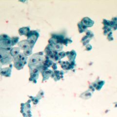 Chromophob - DocCheck Flexikon