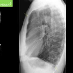 Rippenbogen - DocCheck Flexikon