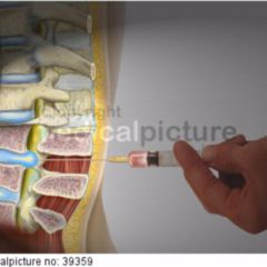 Lymphgefäß - DocCheck Flexikon