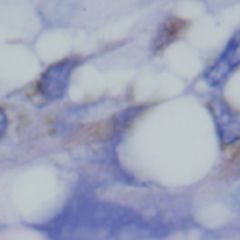 Varizellen - DocCheck Flexikon