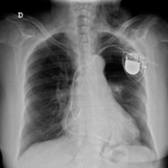 Thorax - DocCheck Flexikon